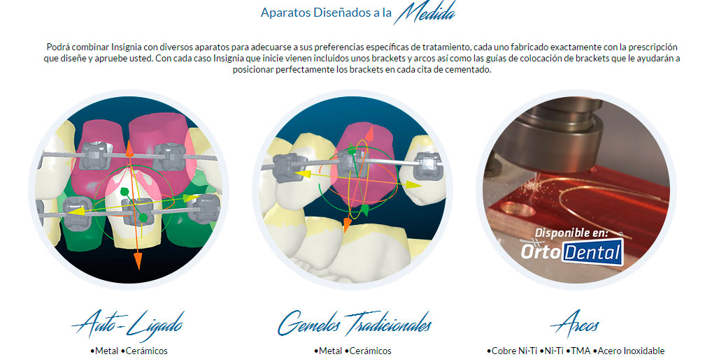 Brackets Insignia, Sistema de Ortodoncia Personalizada | OrtoDental ...