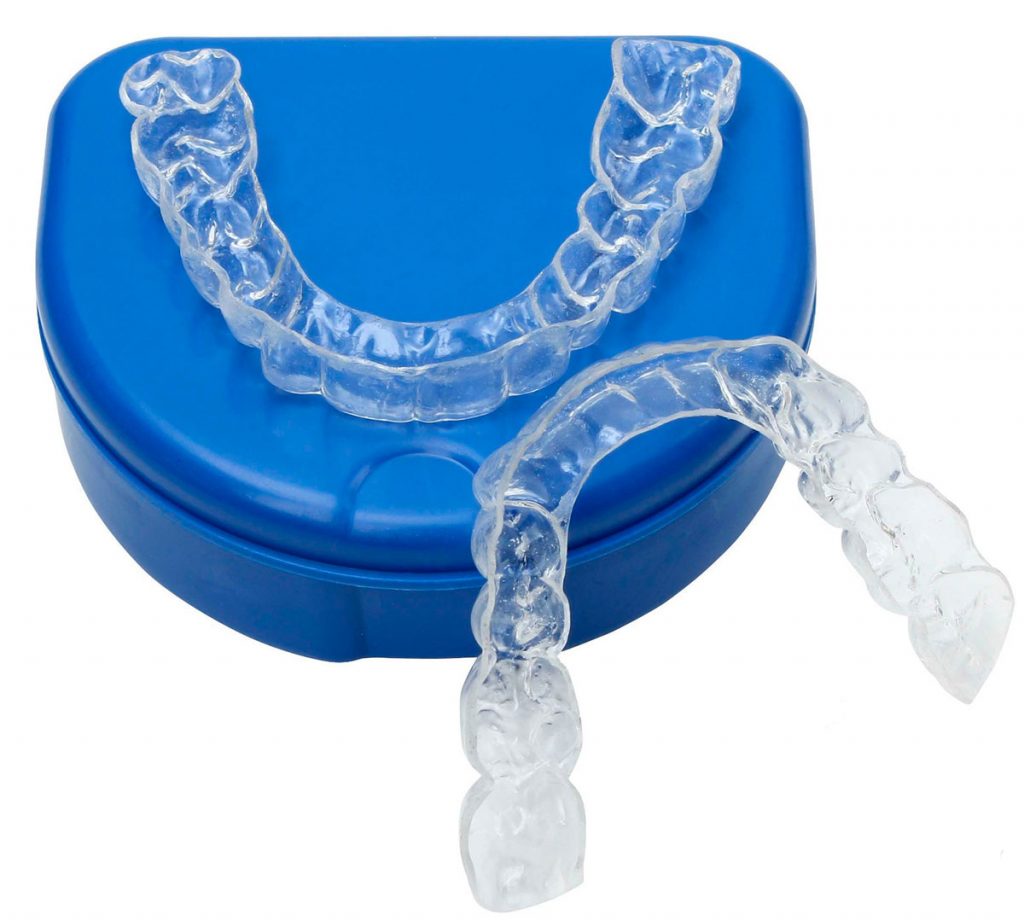 retenedores-ortodoncia-tipo-essix-ortodental | OrtoDental ...