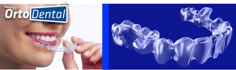 SmartTrack, Alineadores Transparentes con Tecnología | OrtoDental ...