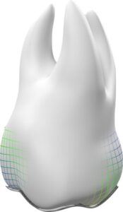 Invisalign G8 llega a México | OrtoDental | Ortodoncista en Mexico CDMX ...