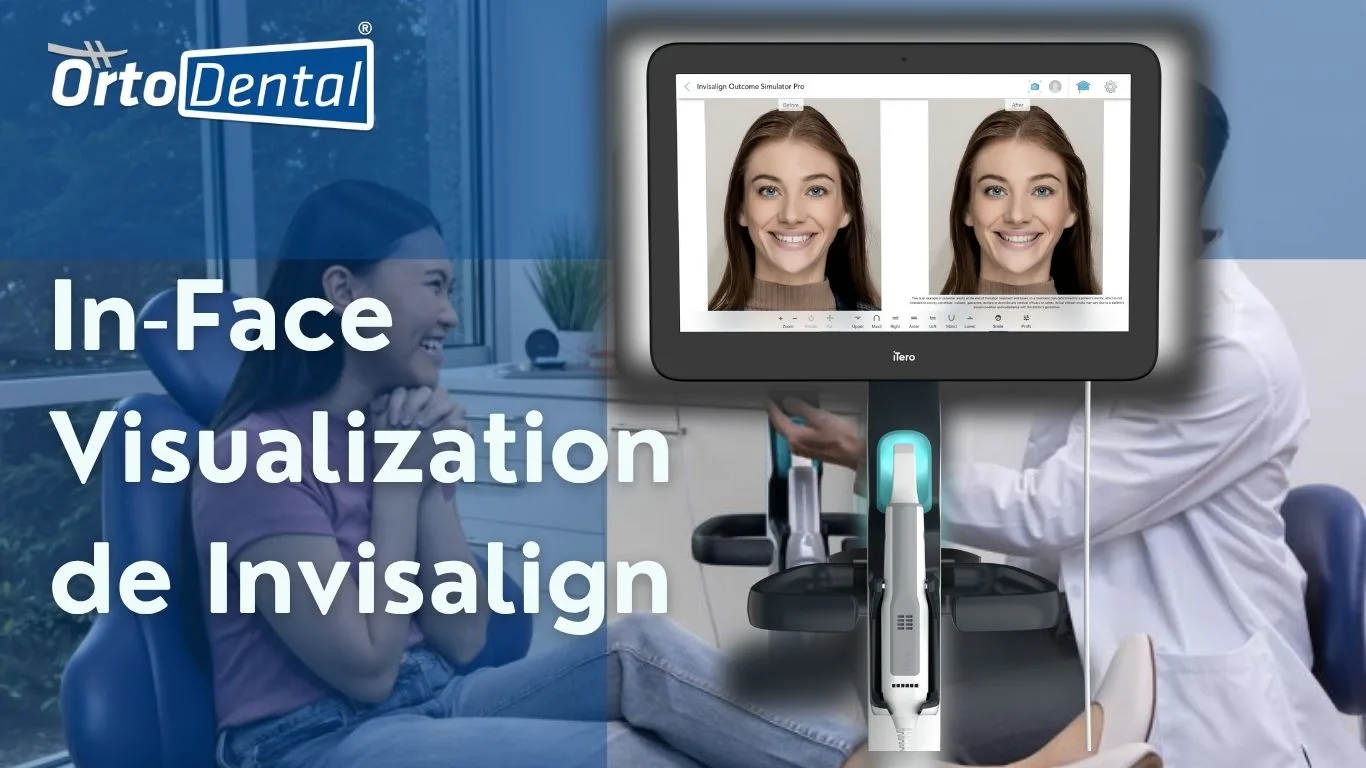 In‑Face Visualization de Invisalign | OrtoDental | Ortodoncista en ...